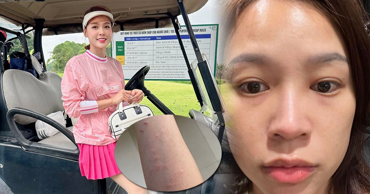 Hot Girl Sam Tái Xuất Sau 6 Tháng Dài đằng đẵng Trị Bệnh Nhan Sắc Gây Chú ý Tinmoi