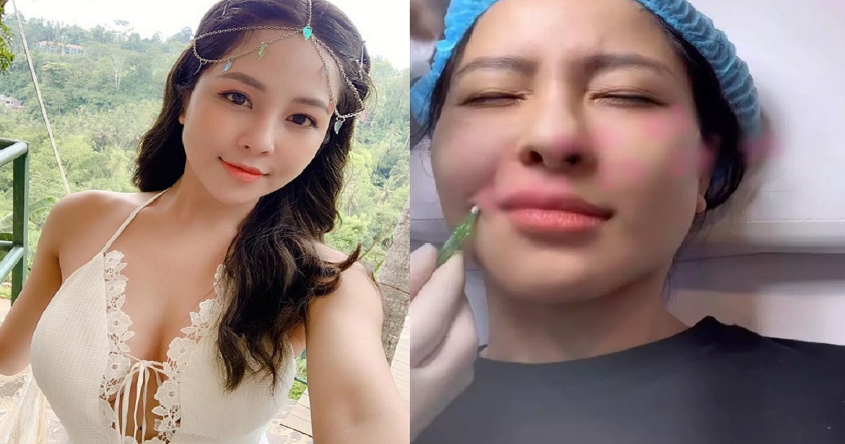 Trâm Anh tung ảnh cận cảnh quá trình 'trùng tu' lại khuôn mặt khiến CDM ngỡ ngàng - Tinmoi